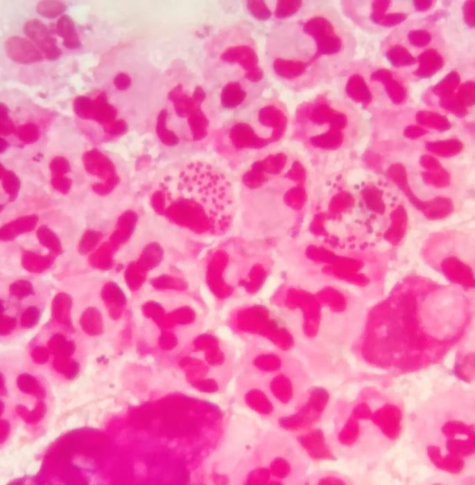 Gonorreia :: Biomedicina-com-amor